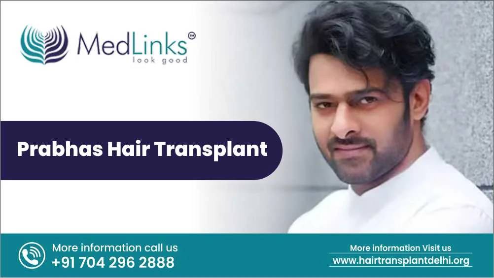 Prabhas Hair Transplant | Medlinks Hair Transplant Delhi